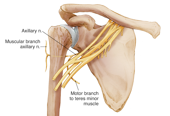 Anterior Shoulder Dislocation Axillary Nerve